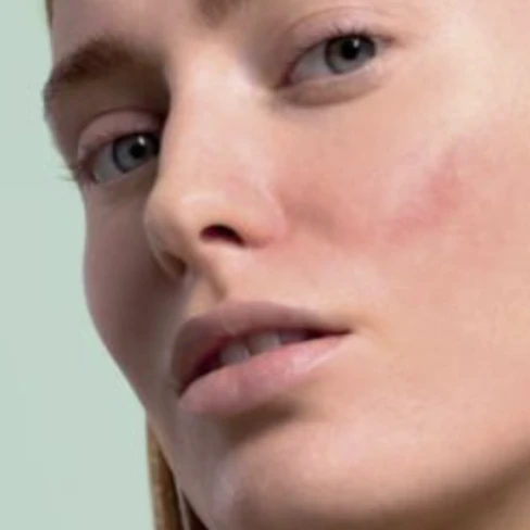 Uriage Toléderm Control Crema de Cuidado Calmante - SweetCare Mexico