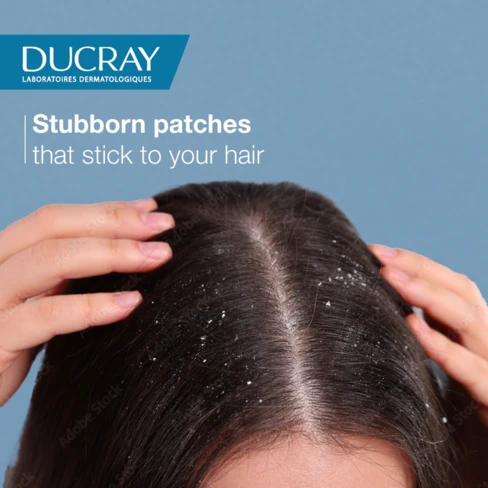 Ducray Squanorm-Kelual Champú Caspa Grasa - SweetCare Costa Rica