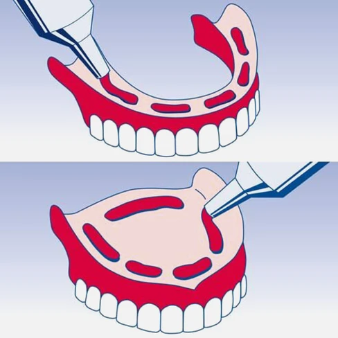 Protefix Extra Strong Adhesive Cream for Dentures SweetCare United States