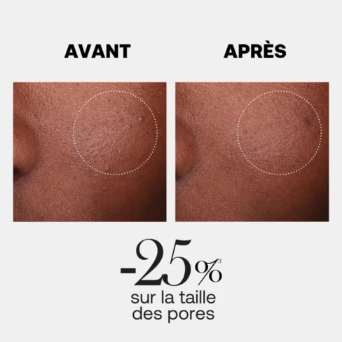 Rexaline Hyalurx Boost Purifying Gentle Lotion for All Skin Types ...