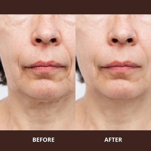 Foreo FAQ 401 Dual Microcurrent and LED Toning Device - SweetCare New ...