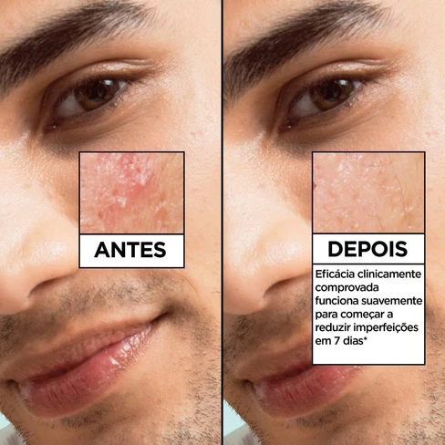 Garnier Pure Active Salicylic Anti-Blemish Face Serum - SweetCare Pakistan