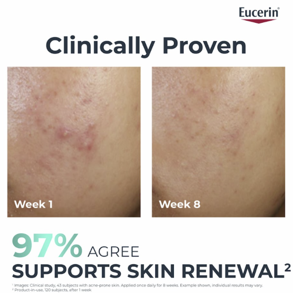 Eucerin Dermopure Clinical Mattifying Fluid Blemish-Prone Skin ...